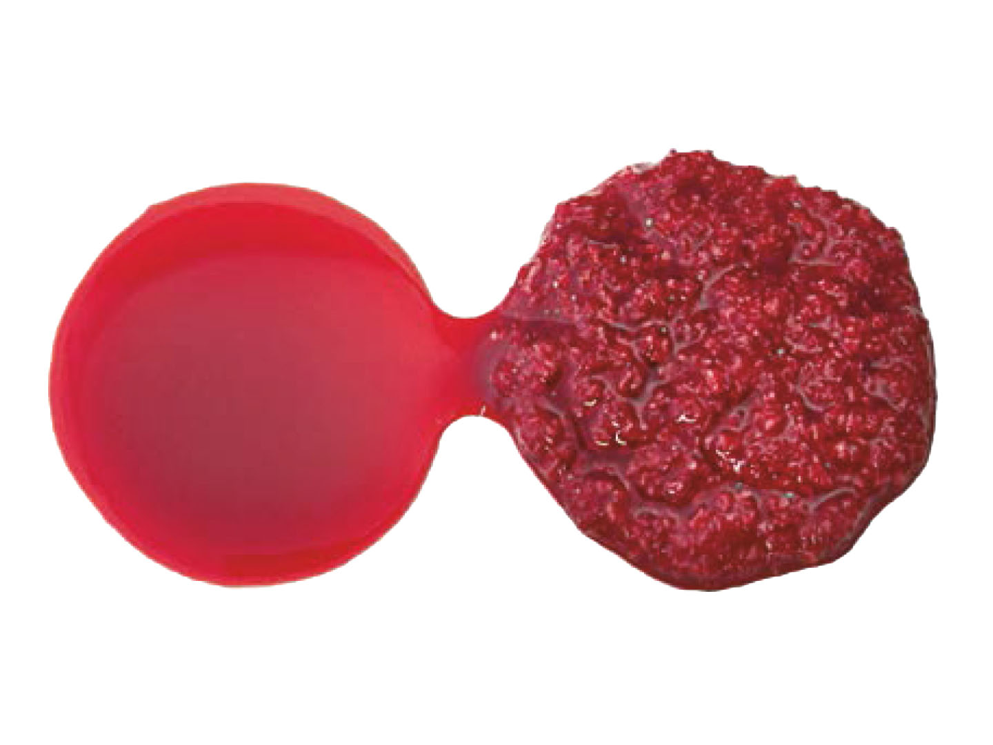 Xenograft: A-Oss – Osstem Implant