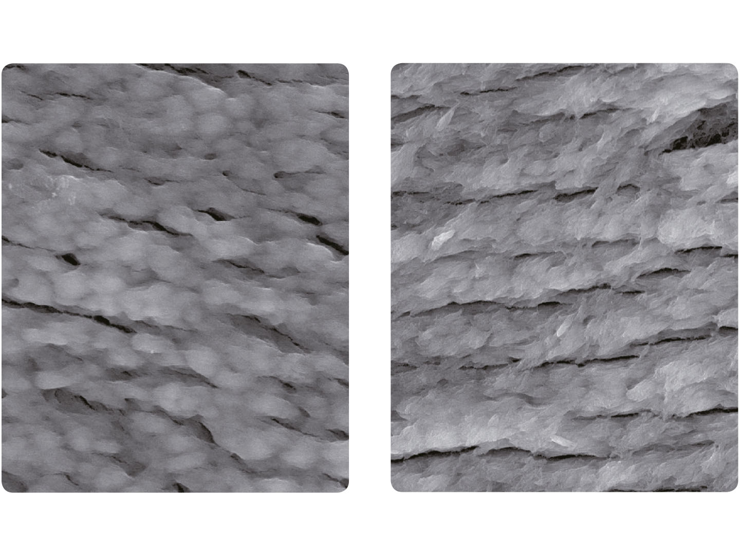 Xenograft: A-Oss – Osstem Implant